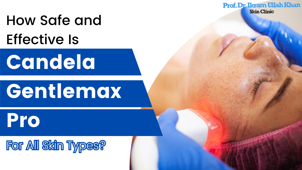 Candela GentleMax Pro: How Is It Safe & Effective for All Skins?
